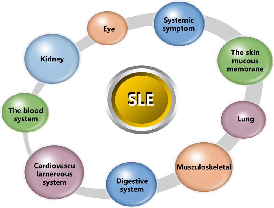 System Lupus Erythematosus (SLE)